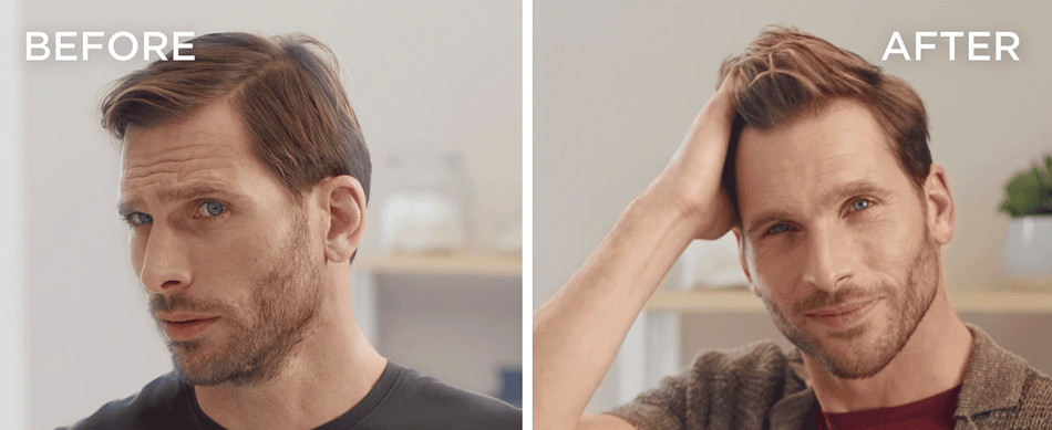 Nioxin System 2 Hair Care Kit – Nioxin Canada